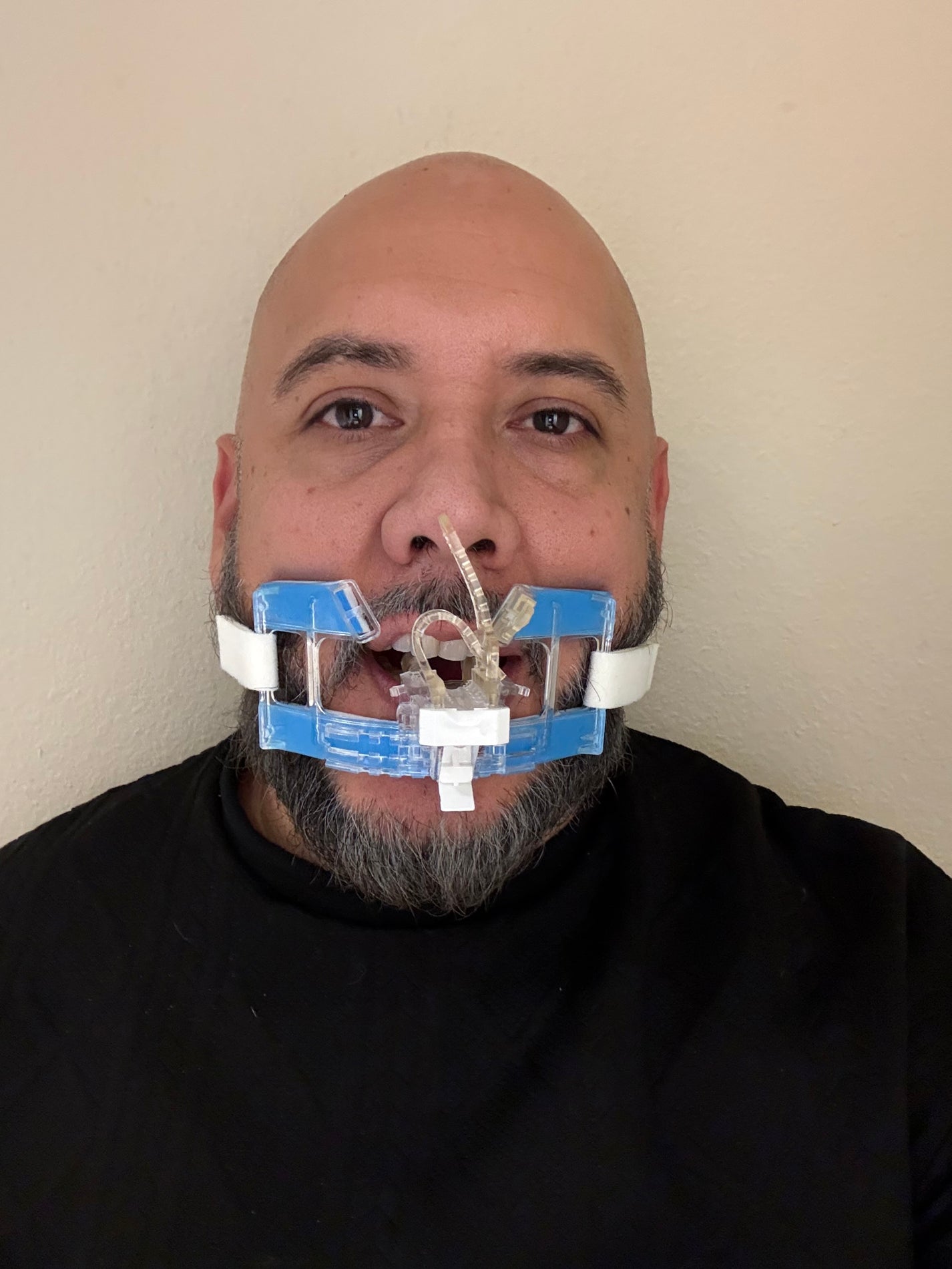 ET-CARE™ Endotracheal Tube Holder (single) – PULMONAIR